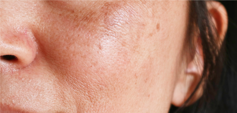 Auro Essentials - Shower Filters That Actually Work